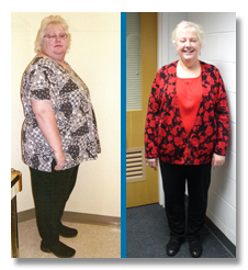 Ohio's Acclaimed Bariatrics Surgery Program Launches New Website to ...