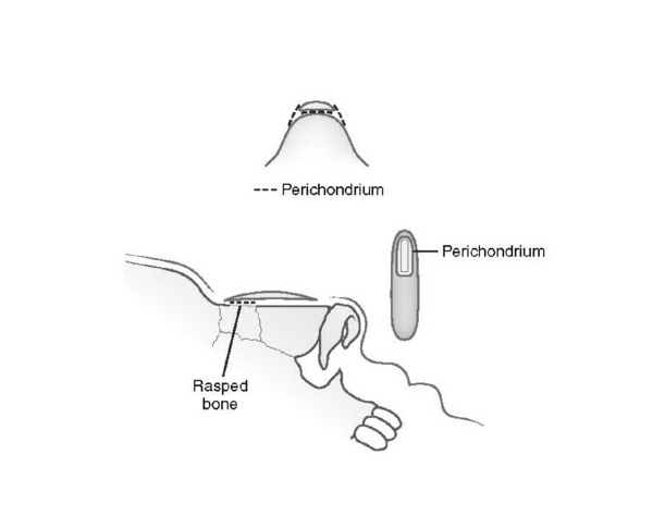 Dr. Dean Toriumi Develops a New Technique for Building a Natural ...