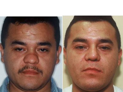 Hispanic Aesthetics Boosted by Dr. Mark Berman, President of the ...