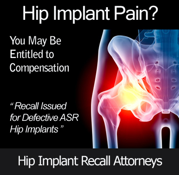Urgent Hip Recall Warning Regarding DePuy Hip Recall Lawsuits