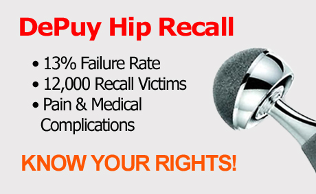 Johnson & Johnson Paying Doctors to Help Obtain DePuy Hip Recall ...