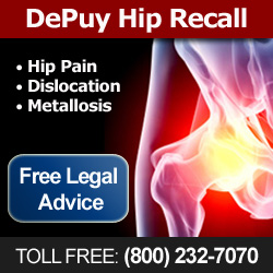 Johnson & Johnson Paying Doctors to Help Obtain DePuy Hip Recall ...