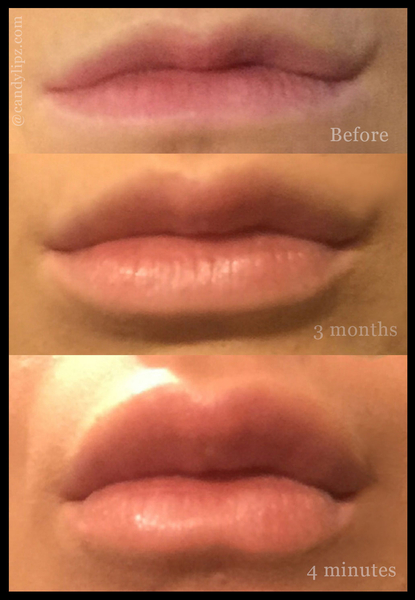 Upturned Lips | Lipstutorial.org