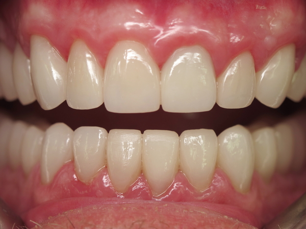 Dr. Keith Warr Achieves Fellowship with Las Vegas Institute (LVI) for ...